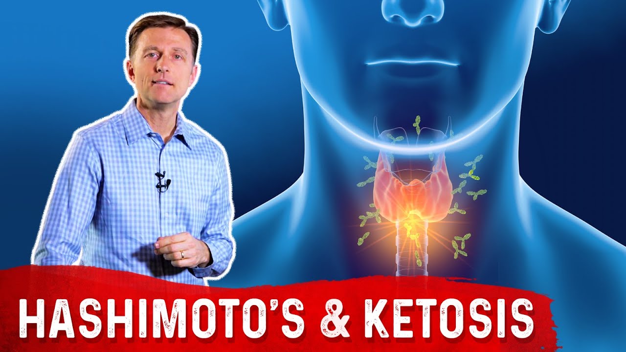 Hashimoto's Disease (Hypothyroid) and Keto (Ketogenic Diet) – Dr. Berg ...